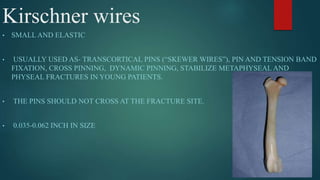 Principle of internal fixation | PPTX