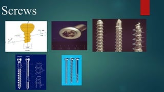 Principle of internal fixation | PPTX