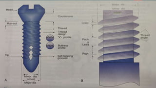 Principle of internal fixation | PPTX