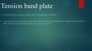 Principle of internal fixation | PPTX