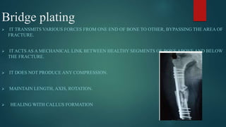Principle of internal fixation | PPTX