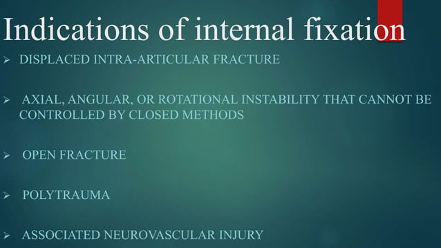Principle of internal fixation | PPTX