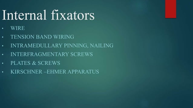 Principle of internal fixation | PPTX