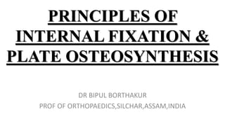 Principle of internal fixation copy | PPTX