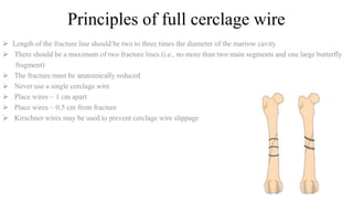 Principle of internal fixation copy | PPTX