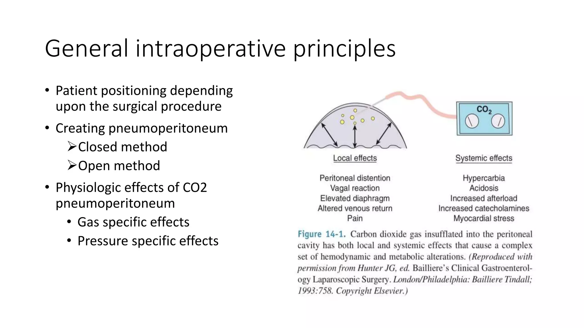 Principle of laparoscopic surgery | PPTX