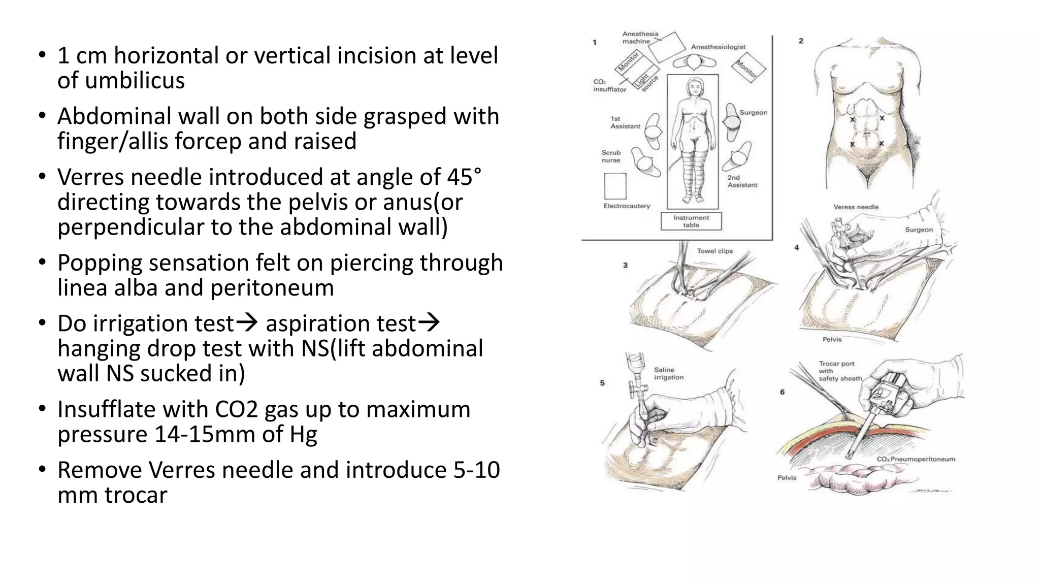 Principle of laparoscopic surgery | PPTX