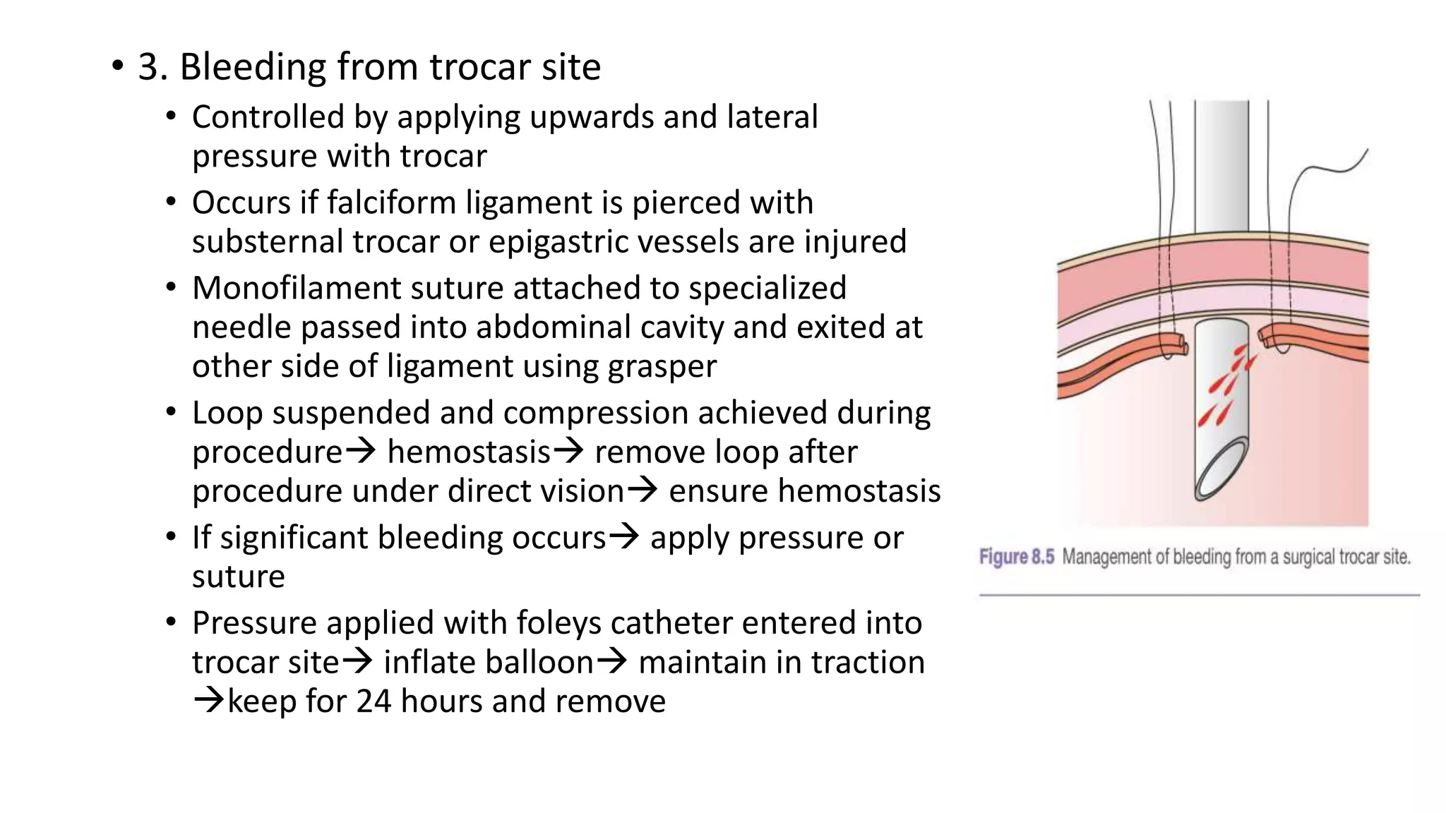 Principle of laparoscopic surgery | PPTX
