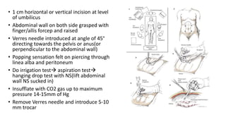 Principle of laparoscopic surgery | PPTX