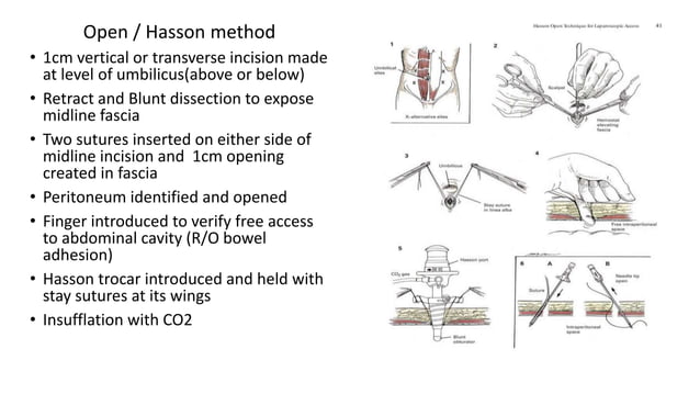 Principle of laparoscopic surgery | PPTX | Digestive Disorders ...