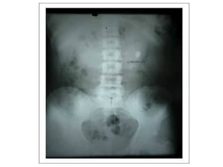 Principle of management of rt flank pain | PPT