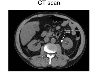 Principle of management of rt flank pain | PPT