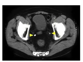 Principle of management of rt flank pain | PPT