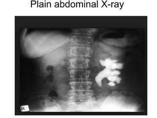 Principle of management of rt flank pain | PPT