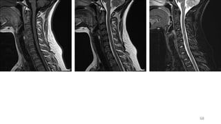 Principle of MRI.pptx