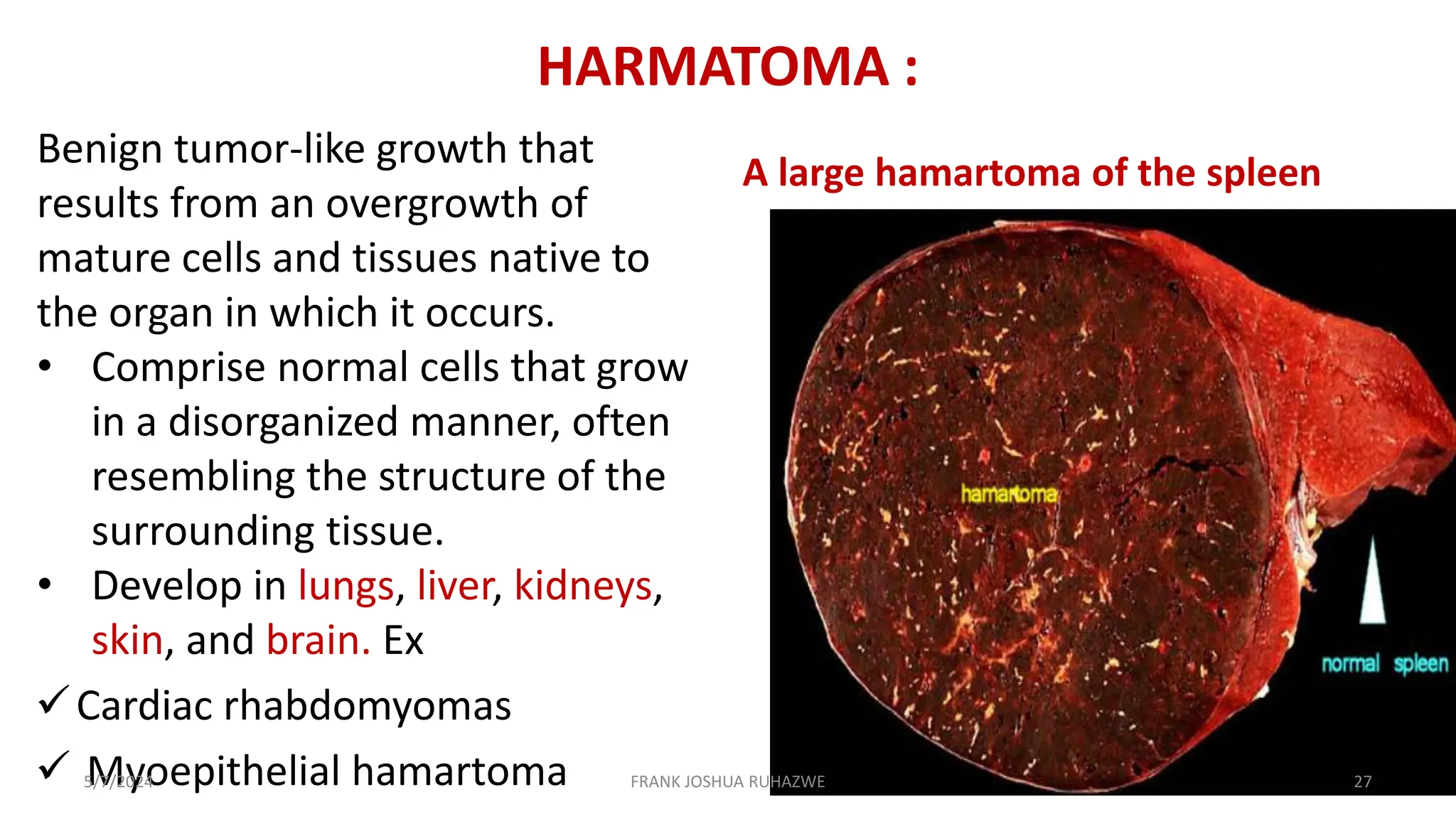 PRINCIPLES OF ONCOLOGY .pptx FRANK JOSHUA RUHAZWE | PPTX | Cancer ...