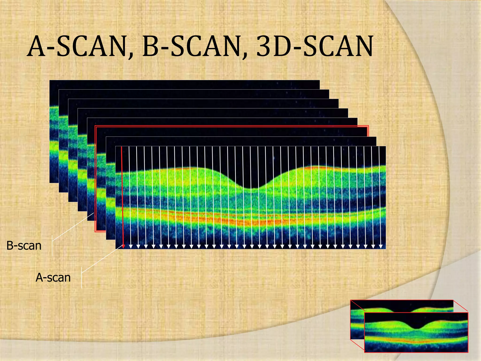 Principles of optical coherence tomography | PPTX