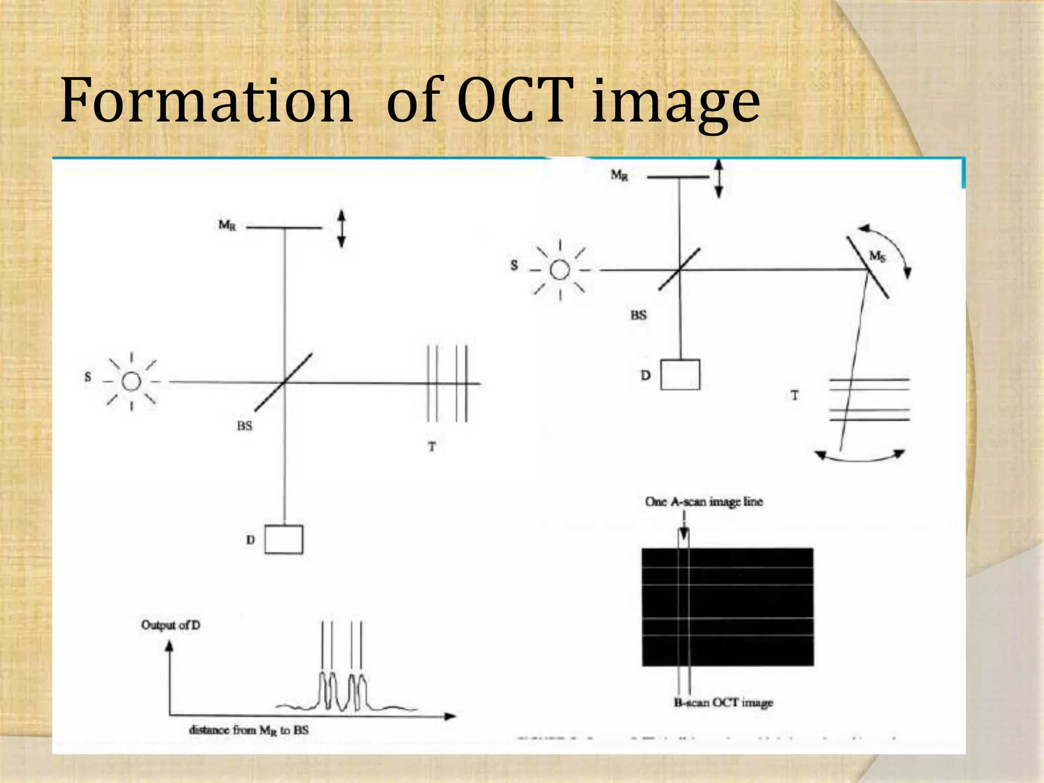 Principles of optical coherence tomography | PPTX