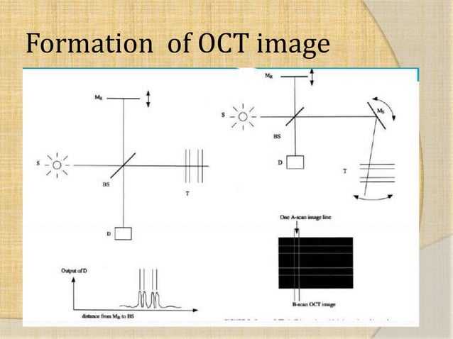Principles of optical coherence tomography | PPTX