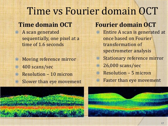 Principles of optical coherence tomography