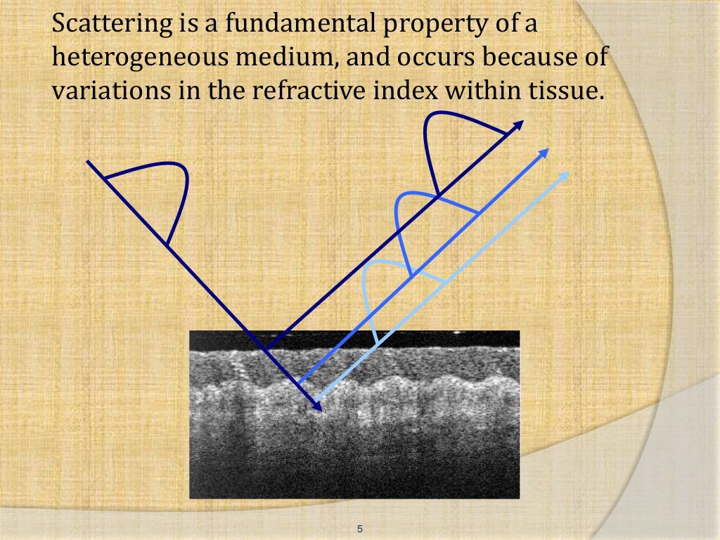 Guide to optical coherence tomography interpretation - questrisk