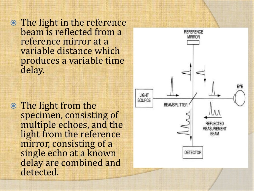 Optical coherence tomography principle - nottiklo