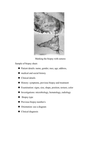 Principle of oral biopsy | PDF