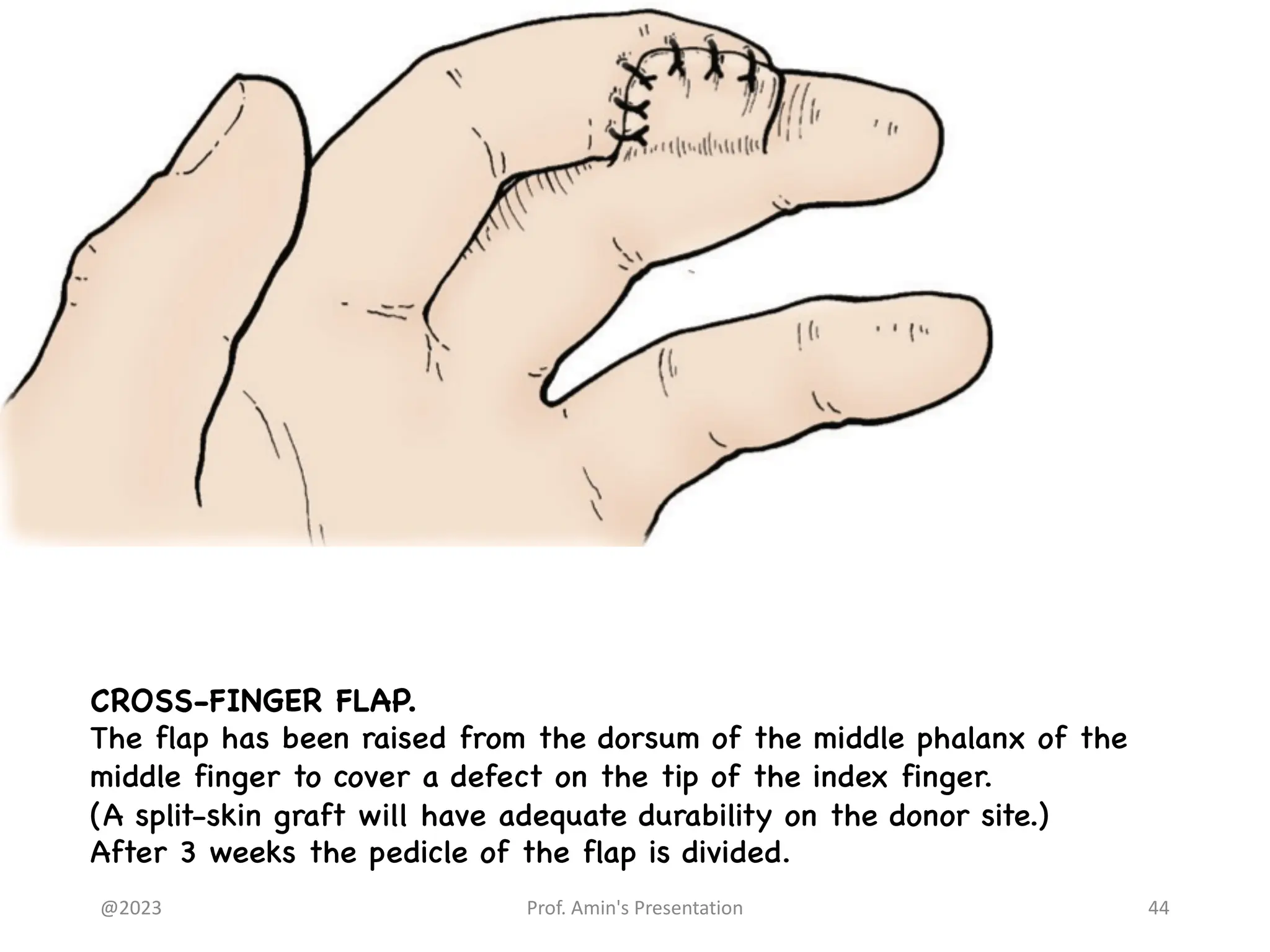 Principle of Plastic Surgery, plastic surgery notes | PDF