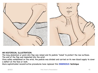 Principle of Plastic Surgery, plastic surgery notes | PDF