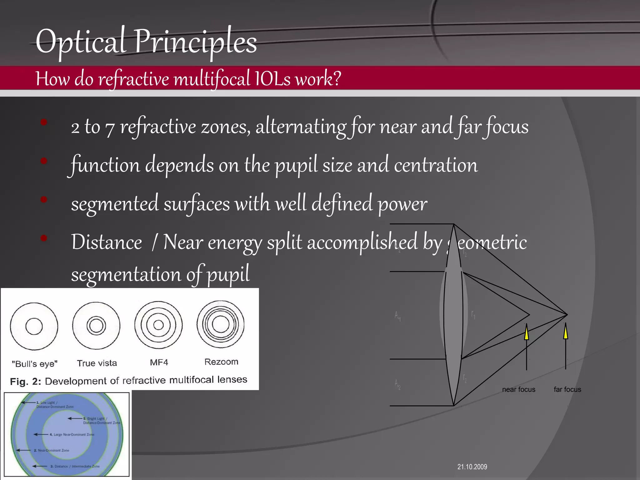 Principle of presbyopia correcting iols | PPT