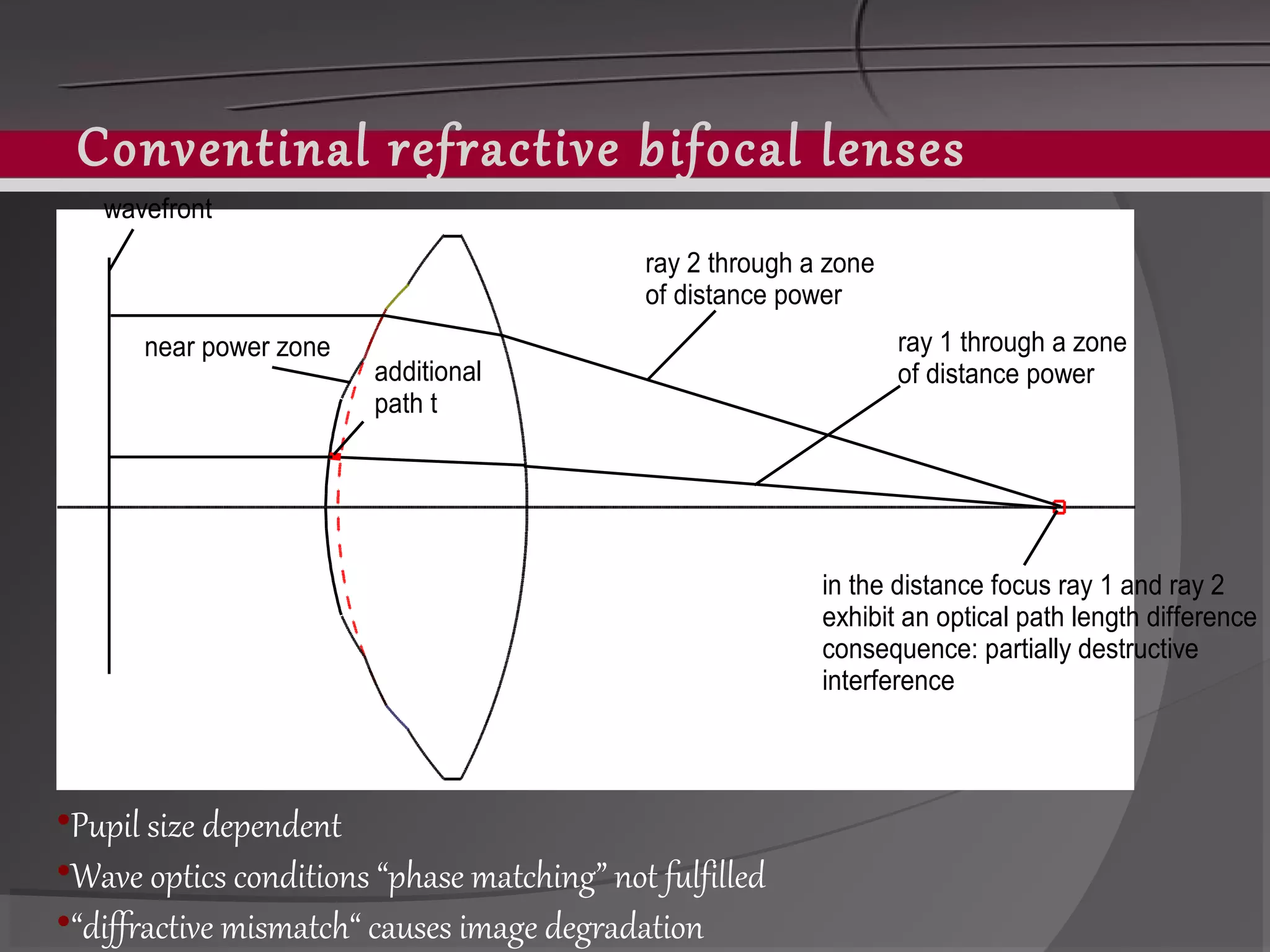 Principle of presbyopia correcting iols | PPT