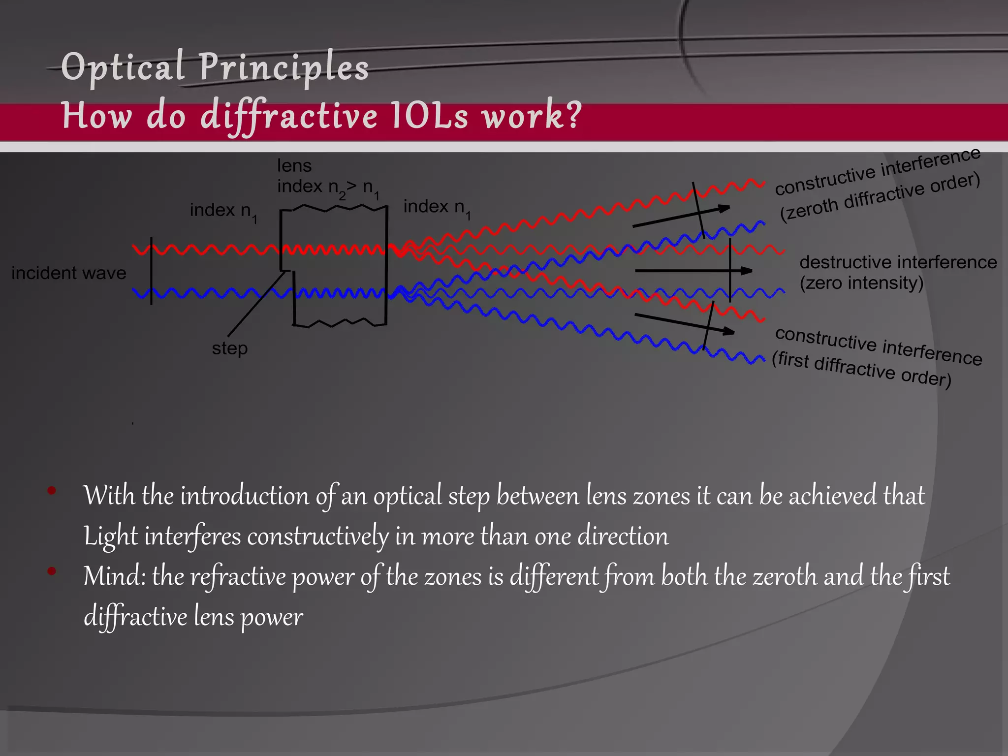 Principle of presbyopia correcting iols | PPT