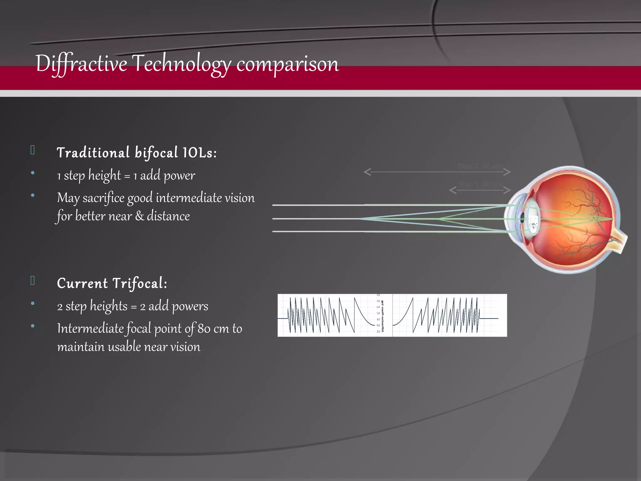 Principle of presbyopia correcting iols | PPT