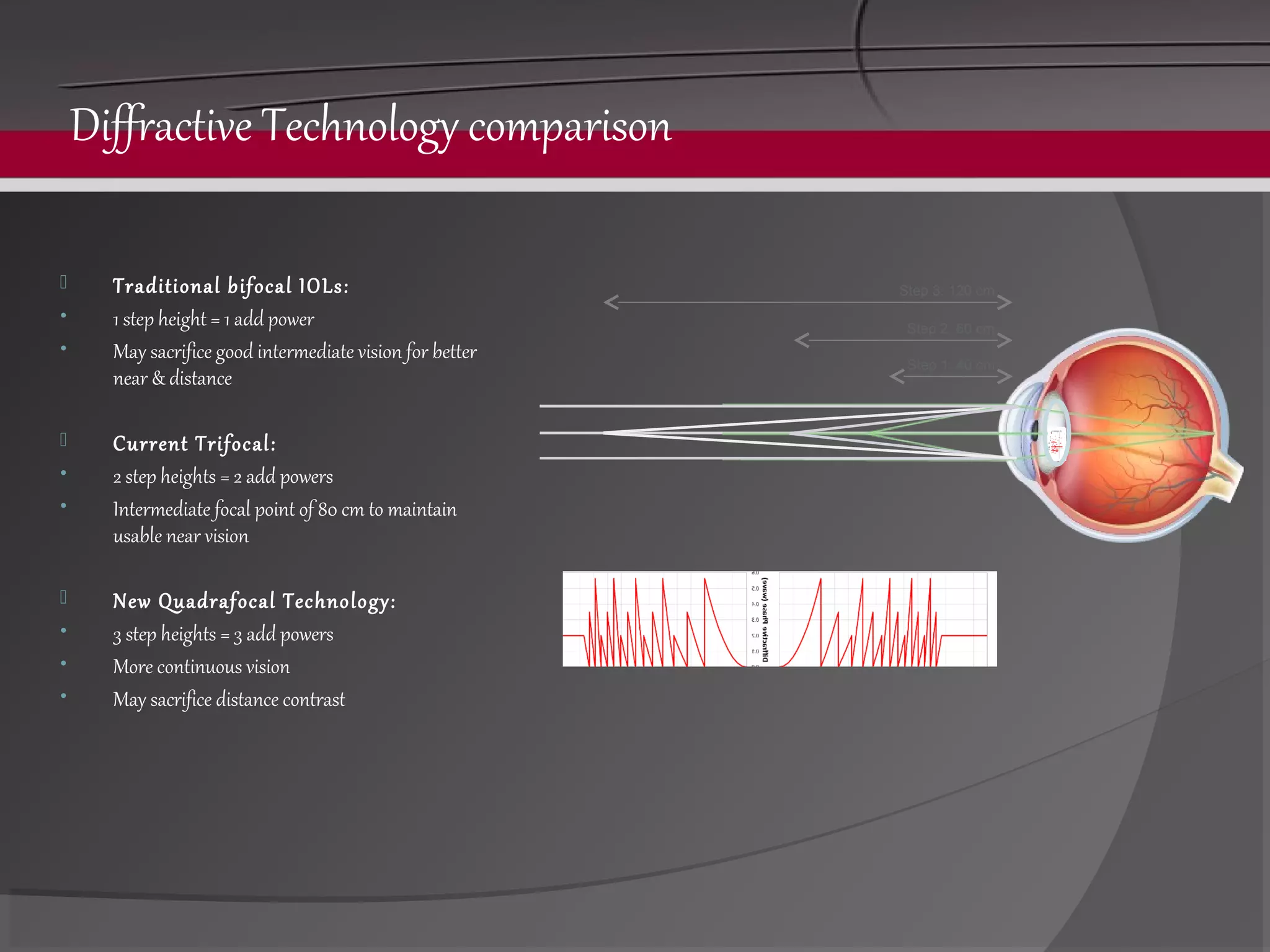 Principle of presbyopia correcting iols | PPT | Eye and Vision ...