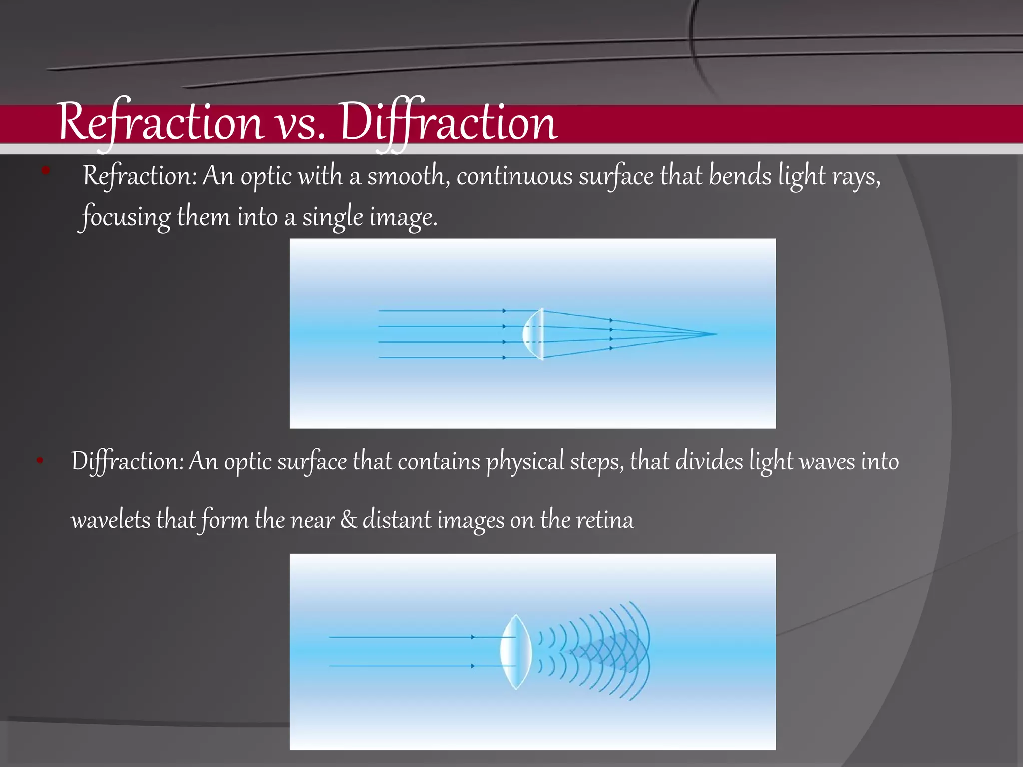 Principle of presbyopia correcting iols | PPT