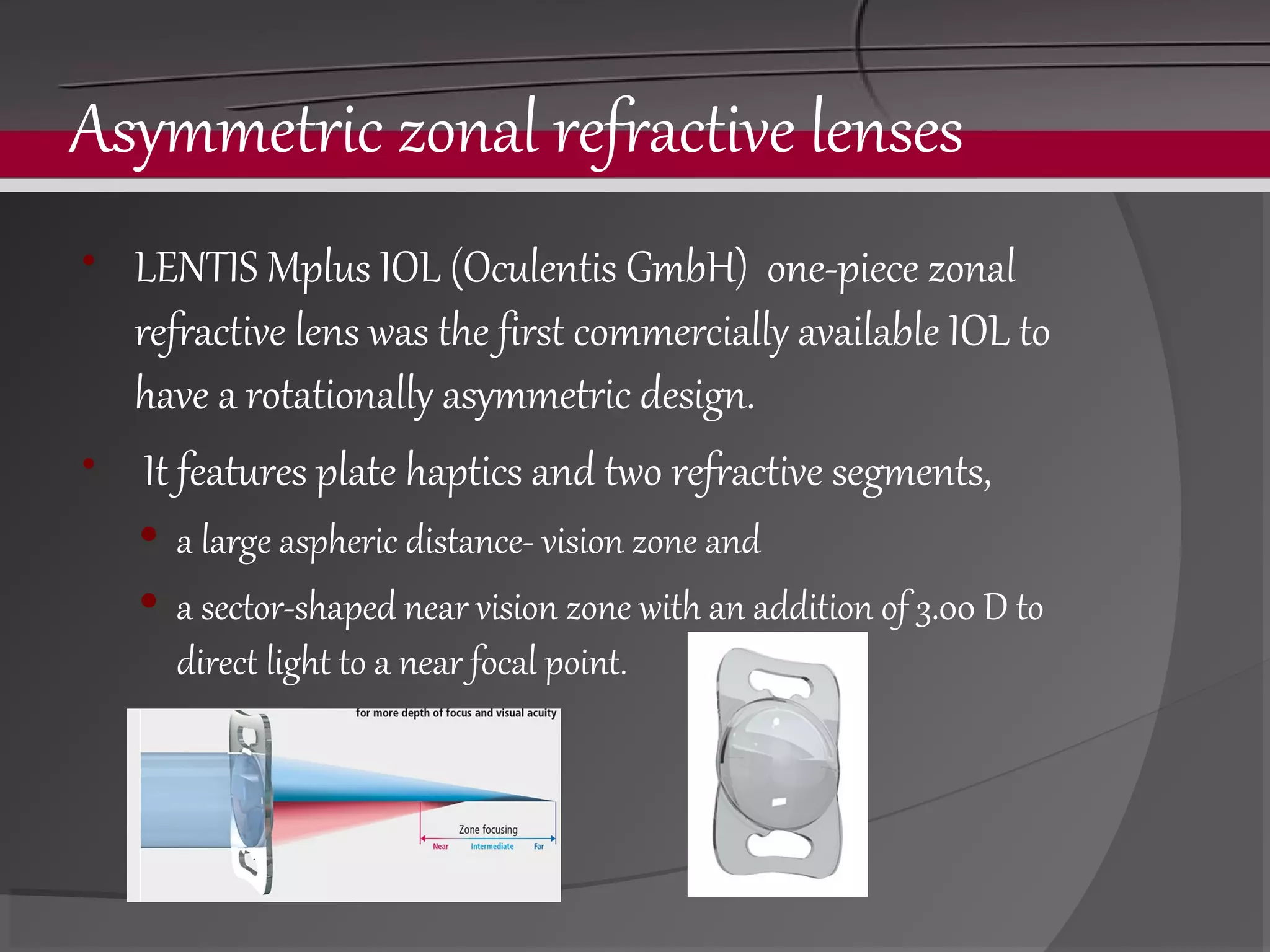 Principle of presbyopia correcting iols | PPT