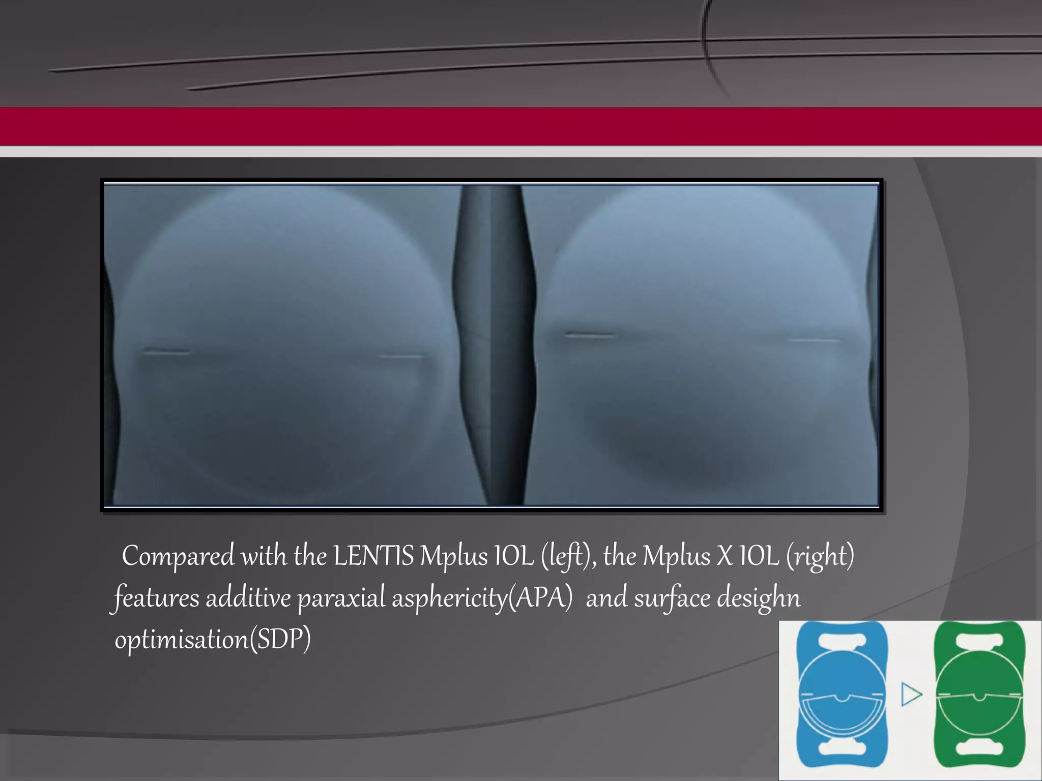 Principle of presbyopia correcting iols | PPT