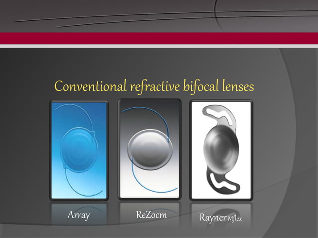 Principle of presbyopia correcting iols | PPT | Eye and Vision ...