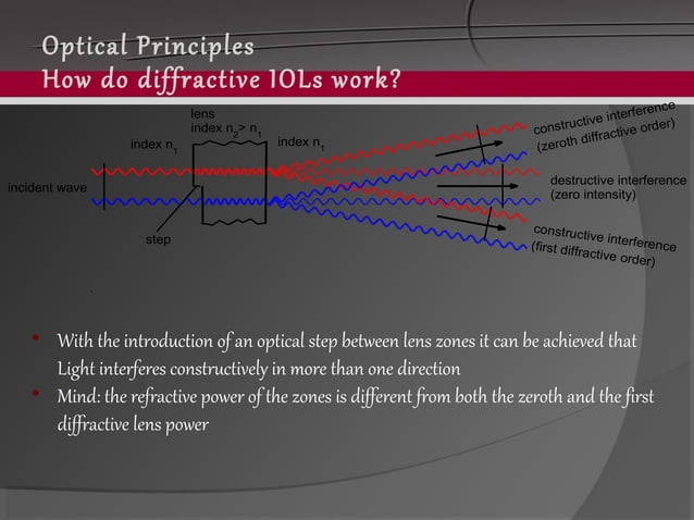 Principle of presbyopia correcting iols | PPT | Eye and Vision ...