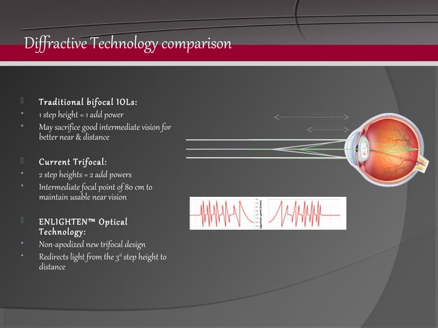Principle of presbyopia correcting iols | PPT | Eye and Vision ...