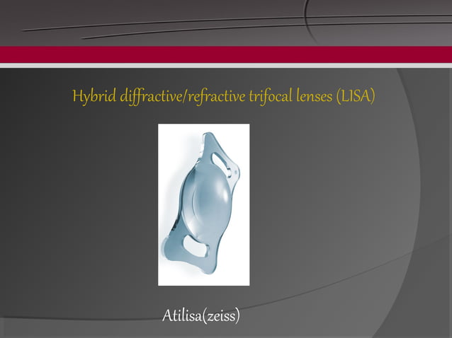Principle of presbyopia correcting iols | PPT | Eye and Vision ...