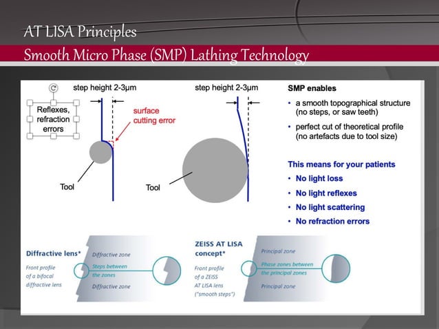 Principle of presbyopia correcting iols | PPT | Eye and Vision ...