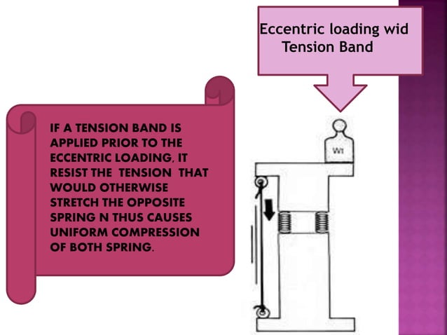 Principle of tension band wiring n its application | PPTX