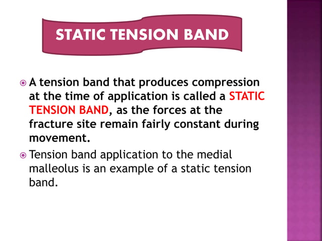 Principle of tension band wiring n its application | PPTX