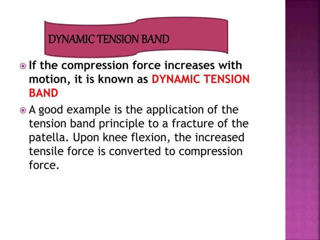 Principle of tension band wiring n its application | PPTX
