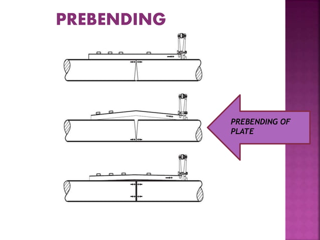 Principle of tension band wiring n its application | PPTX