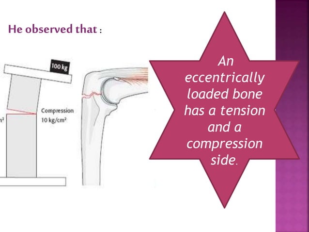 Principle of tension band wiring n its application | PPTX