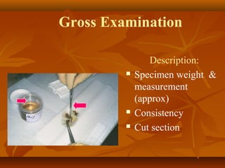 Principle of tissue processing | PPT