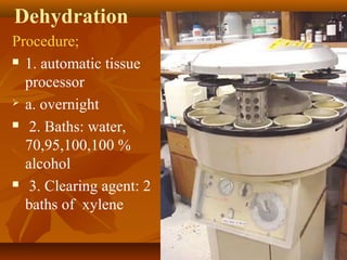 Principle of tissue processing | PPT