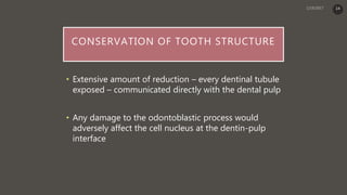 Principle of tooth preparation | PPTX